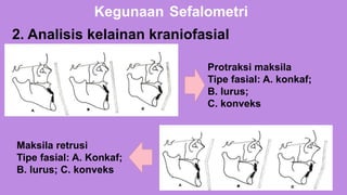 Pengertian Sefalometri .pptx