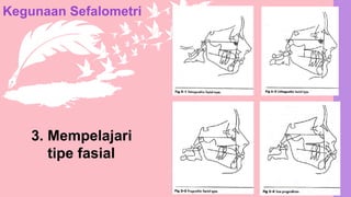 Pengertian Sefalometri .pptx