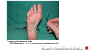 Penggunaan Obat Pada Neuropati dan Foot Ulcer Diabetik.pdf