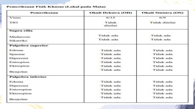 Penggunaan Refraksi Siklopegik pada kelainan refraksi anak ...