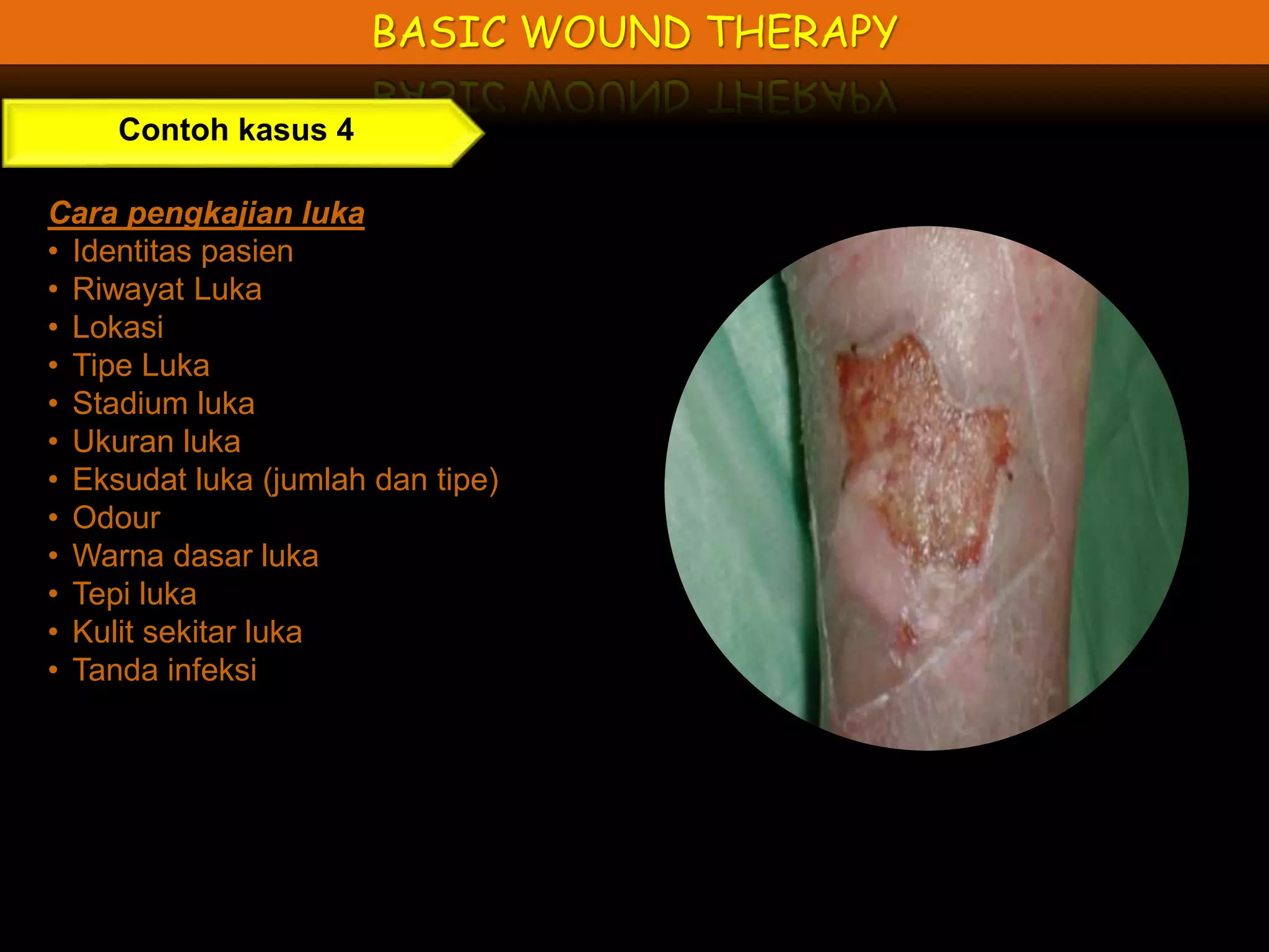 Pengkajian-Luka.ppt