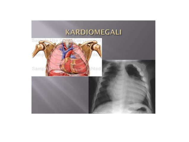 PENGKAJIAN_SISTEM_KARDIOVASKULER_II.pptx