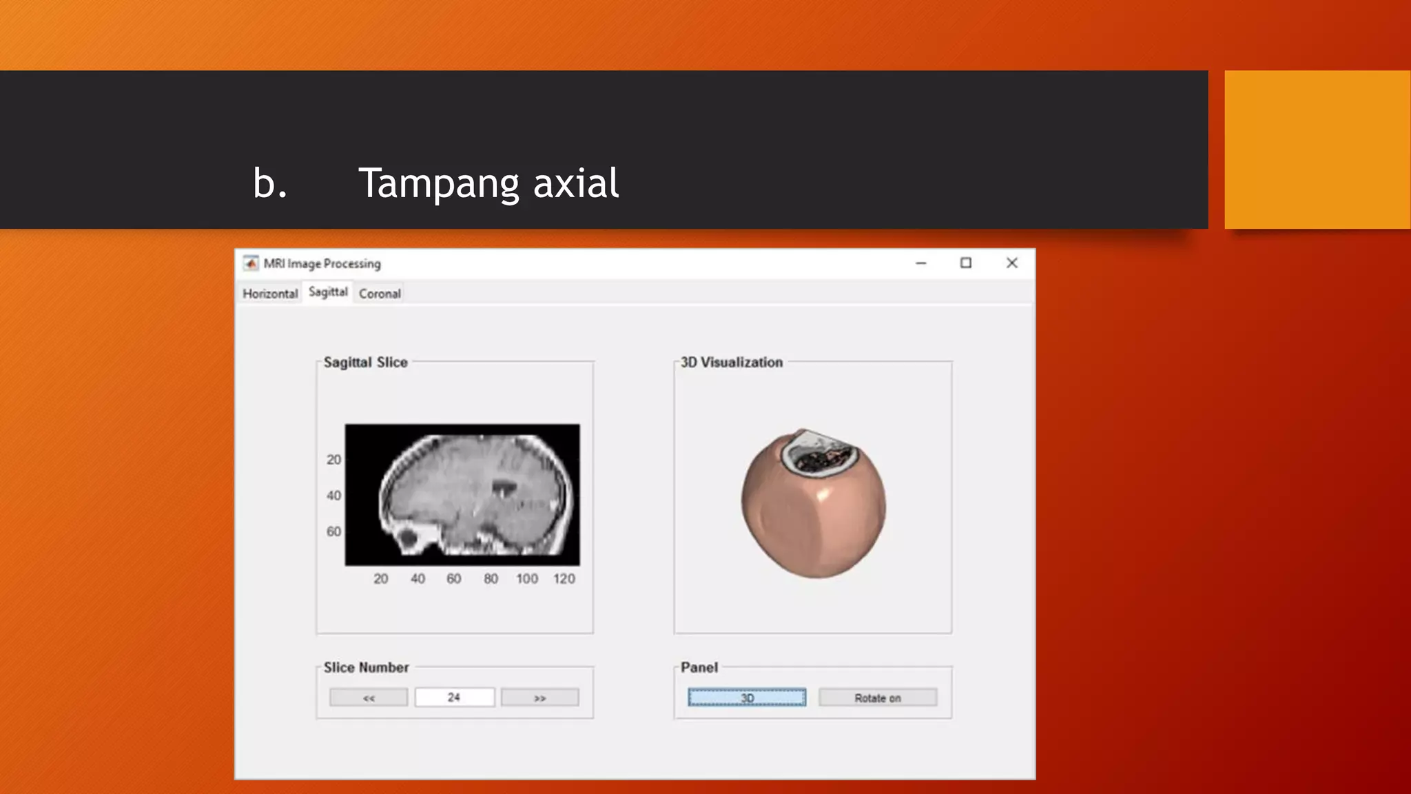 ppt Pengolahan citra digital pada modalitas MRI | PPTX