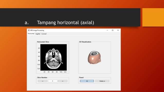 ppt Pengolahan citra digital pada modalitas MRI | PPTX
