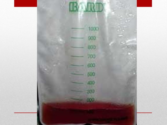 PENGUKURAN CECAIR - INTAKE OUTPUT | PPT