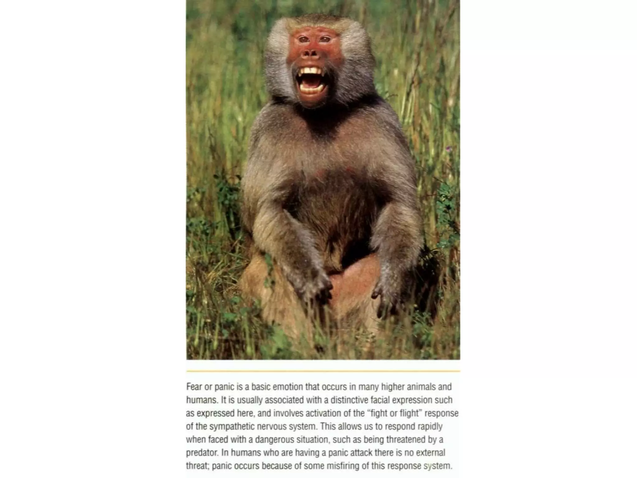 Pengurusan stress dan kesihatan mental | PPTX