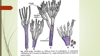 Penicillium Slide Labeled