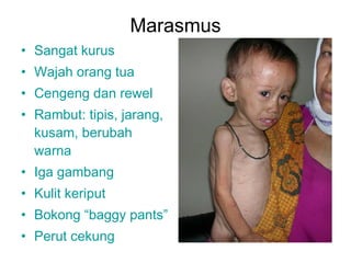 Penilaian secara klinik | PPT