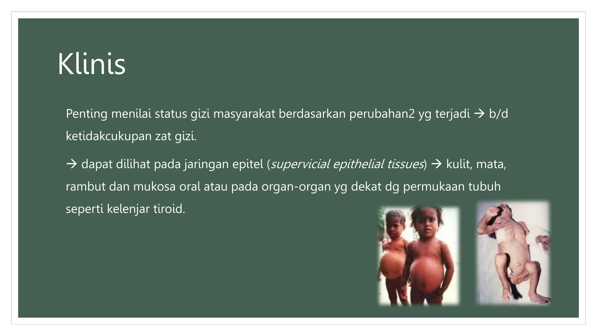 Penilaian status gizi - seila.pptx