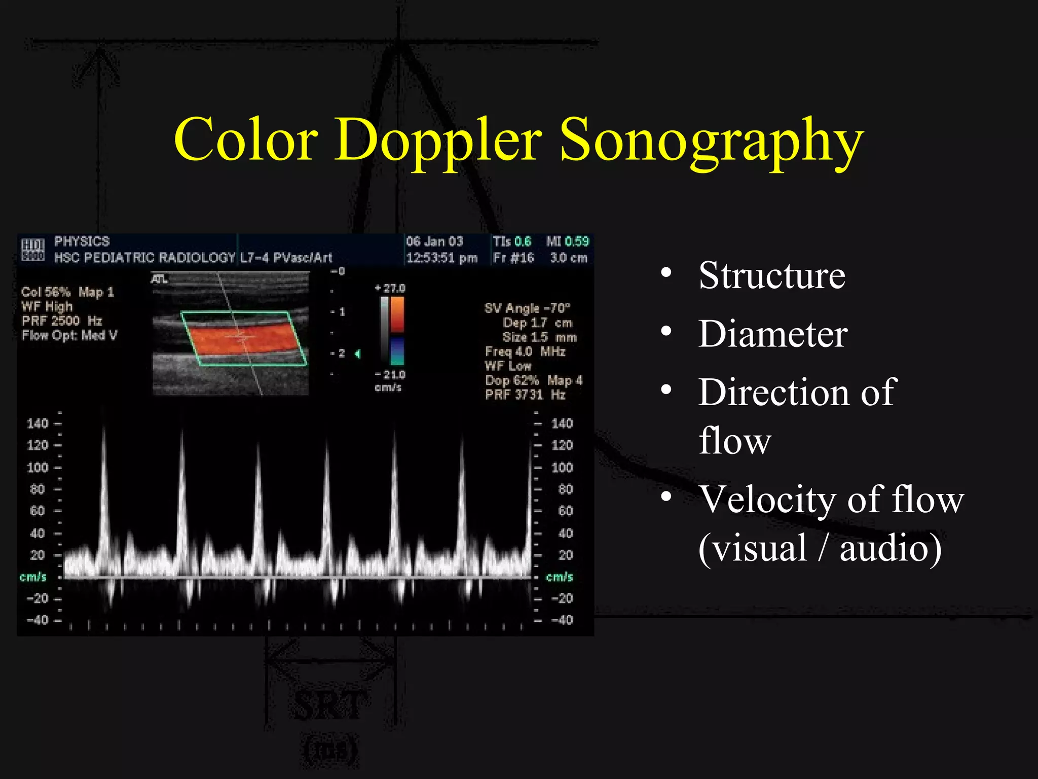 Penile Color Doppler Evaluation for Erectile Dysfunction | PPT