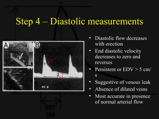 Penile Color Doppler Evaluation for Erectile Dysfunction | PPT