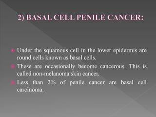 Penile cancer | PPTX