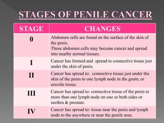 Penile Cancer Staging
