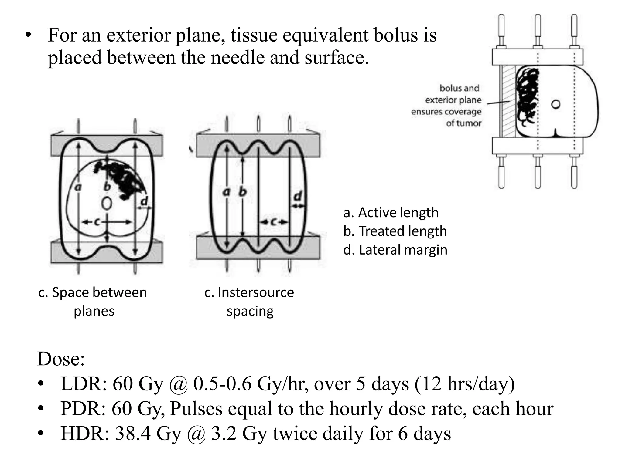 penilecarcinoma-DR KIRAN.pptx