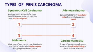 Penile Carcinoma by Ashutosh Rao 2.pdf