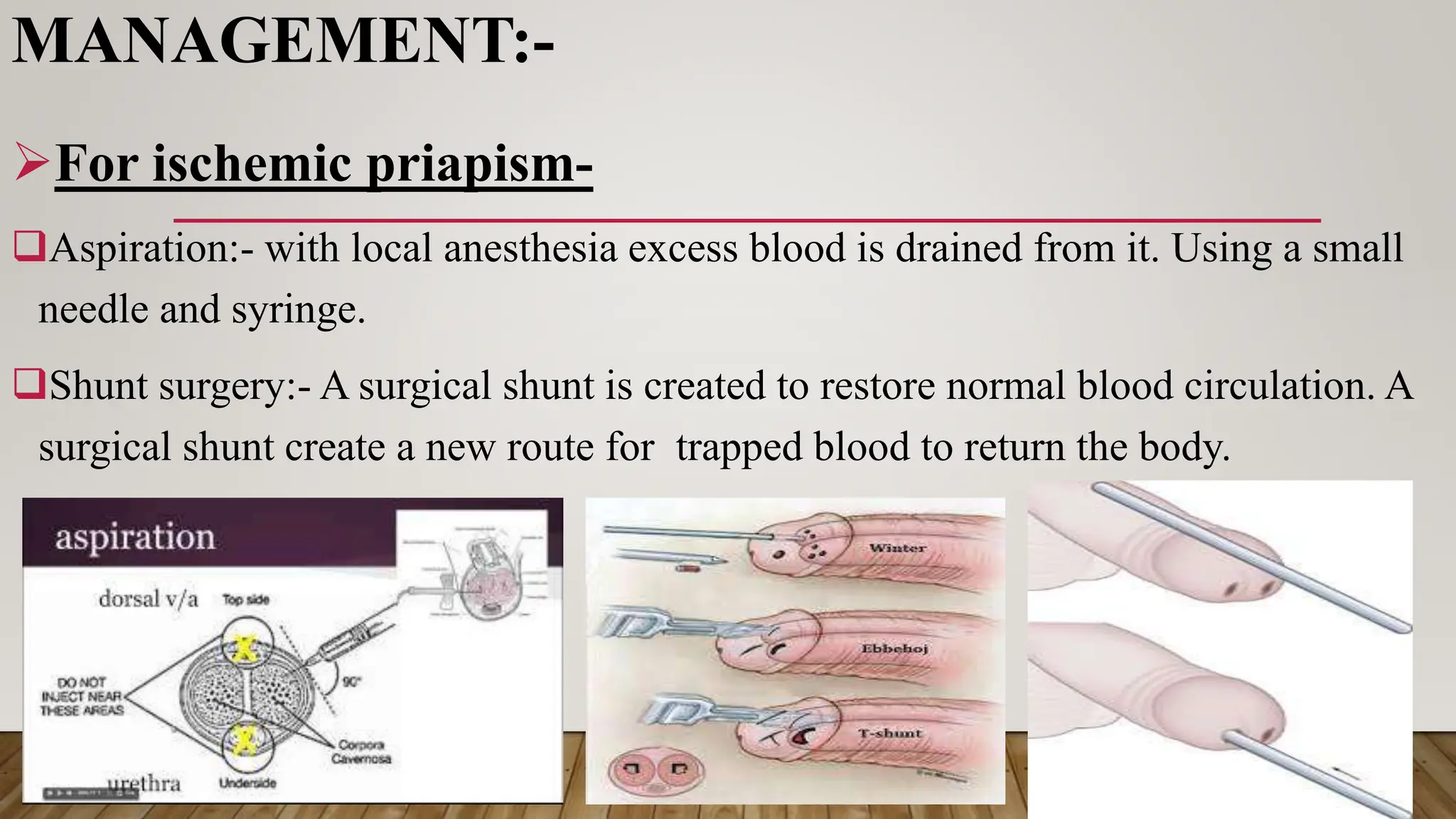 Penile disorders.pptx