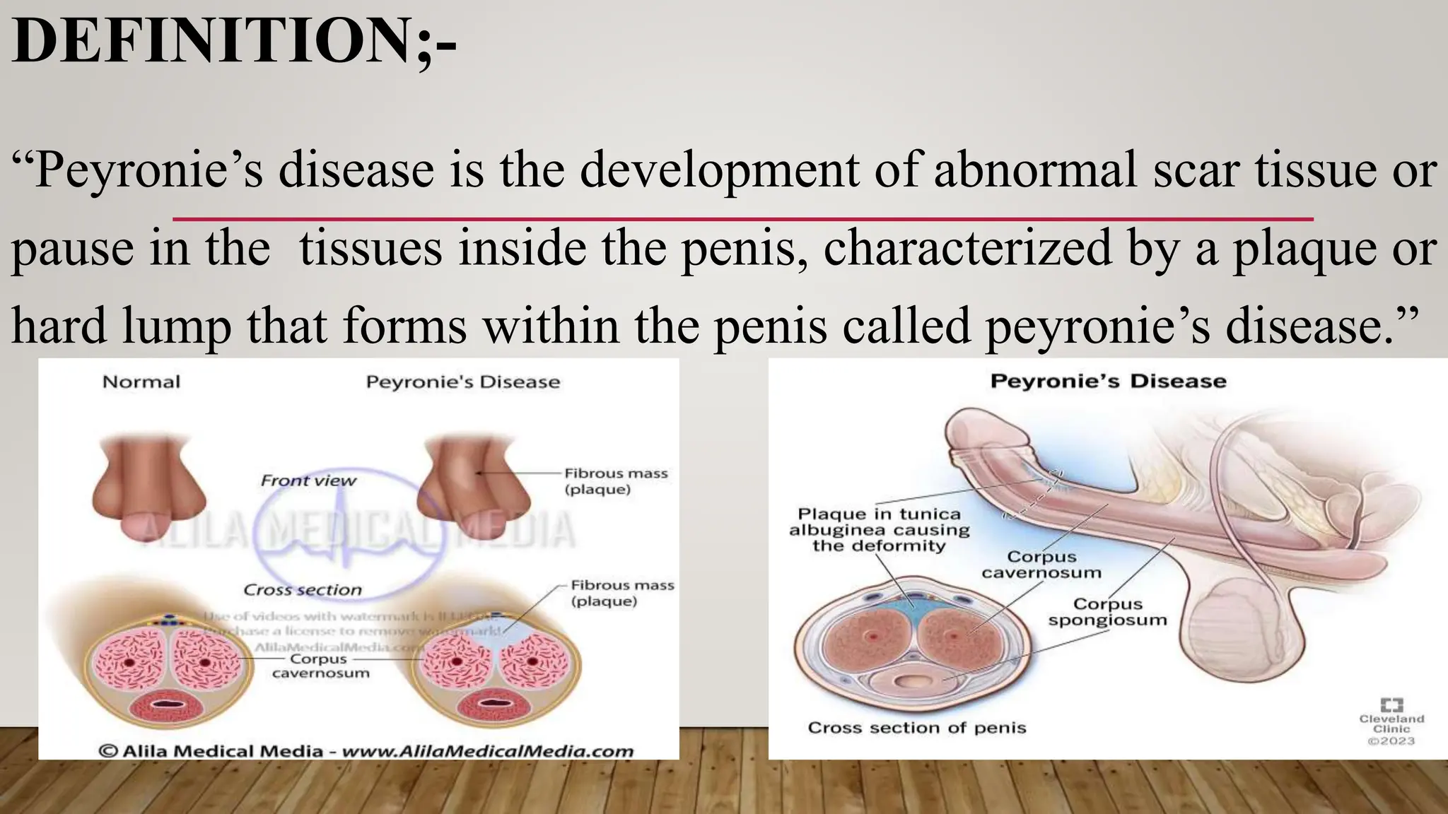 Penile disorders.pptx