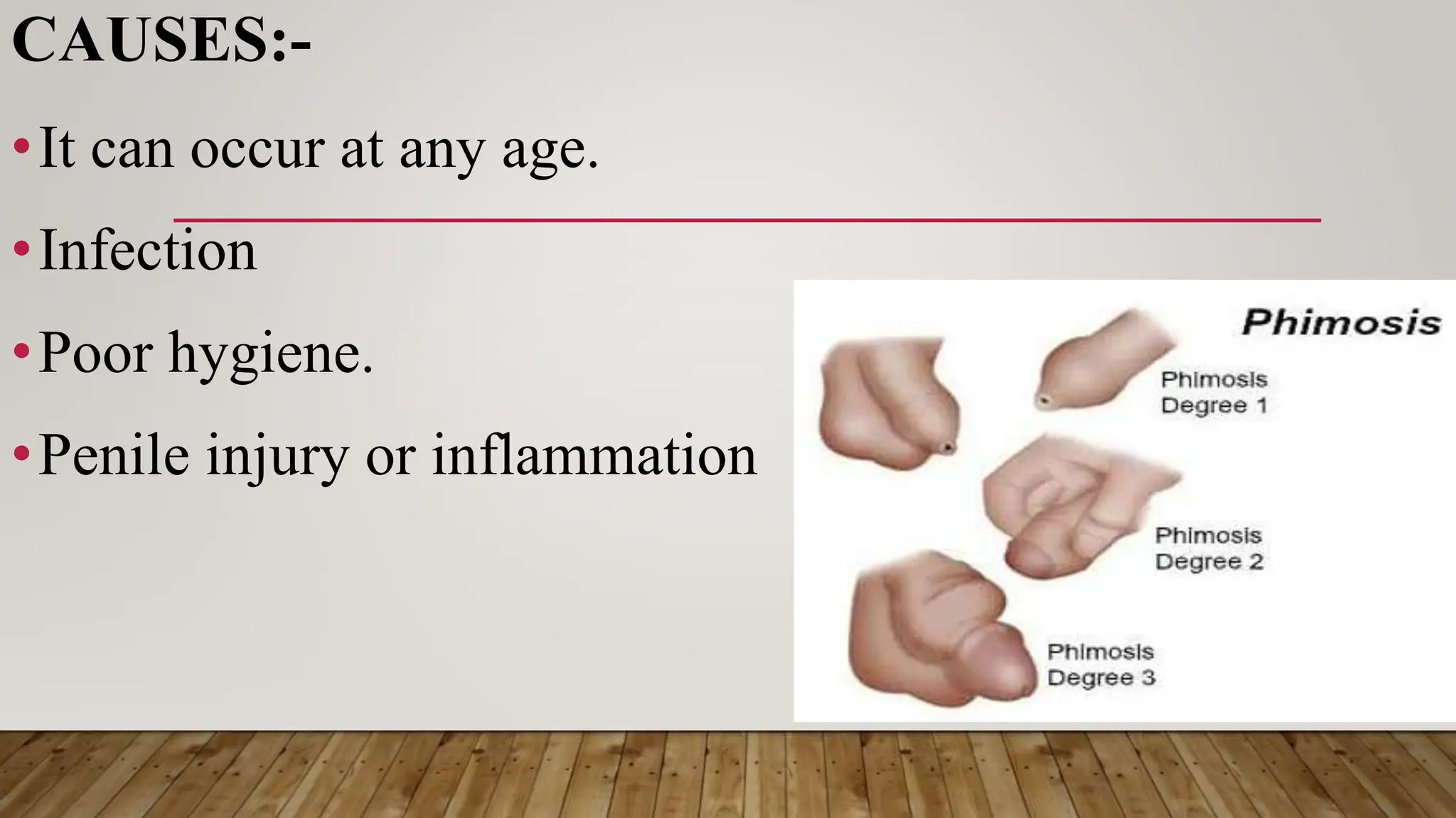 Penile disorders.pptx