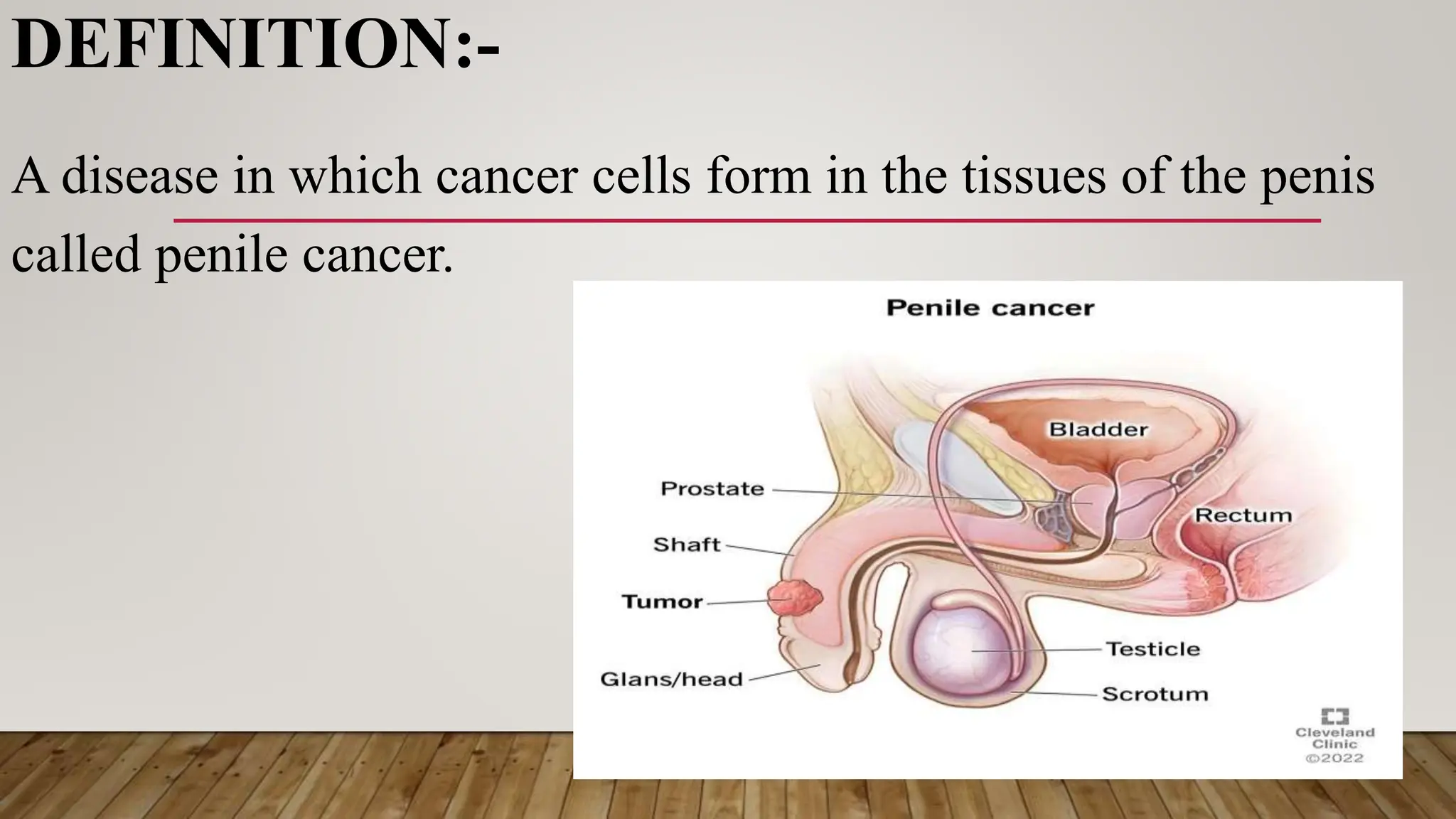 Penile disorders.pptx