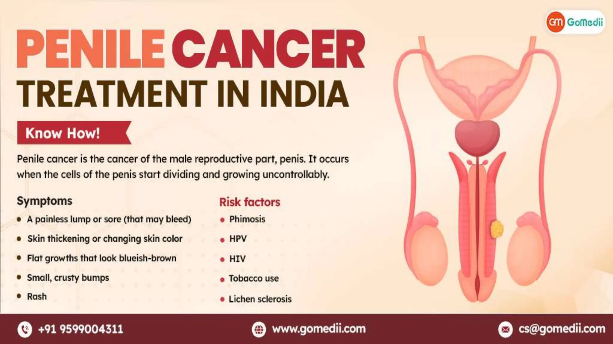 Penile disorders.pptx