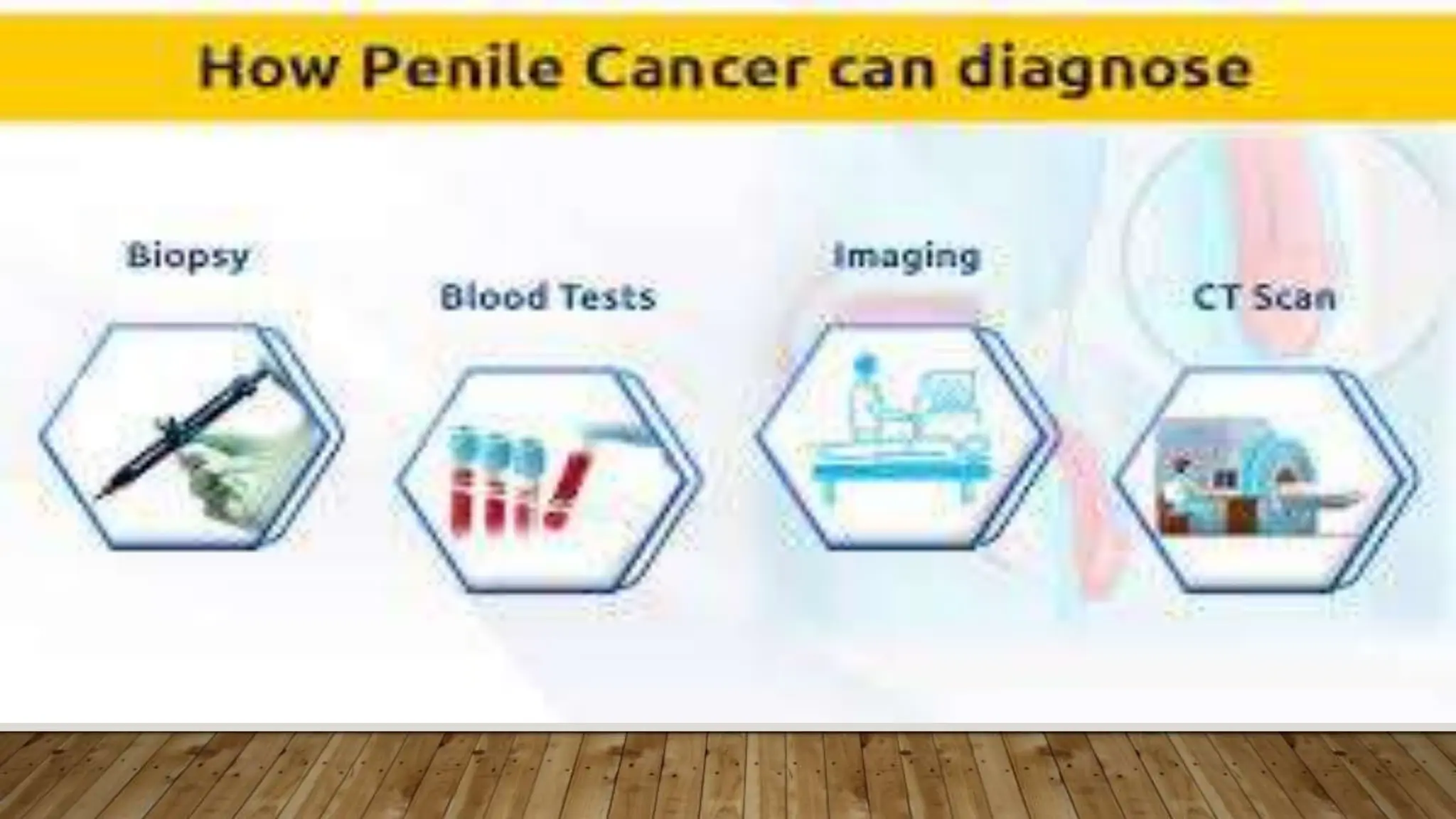 Penile disorders.pptx