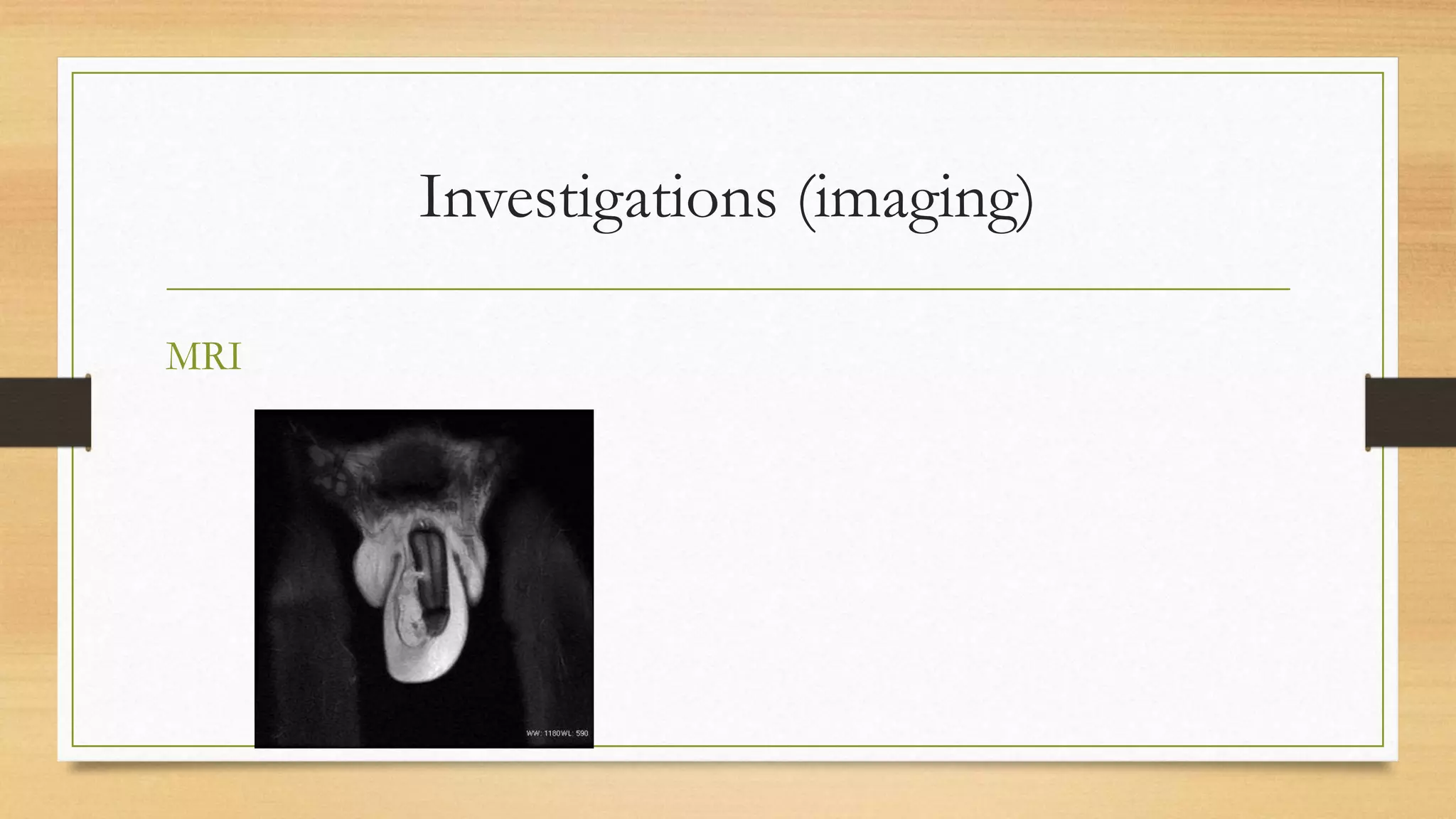 Penile fracture | PPTX
