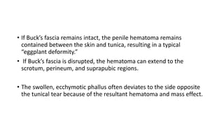 PENILE FRACTURE.pptx