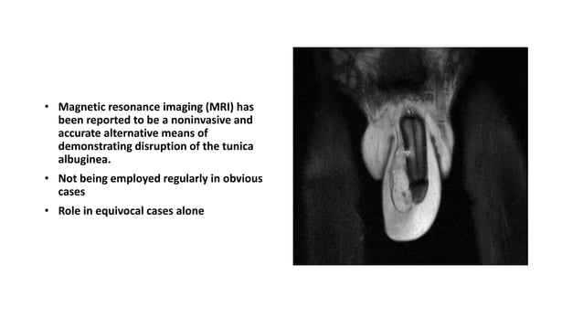 PENILE FRACTURE.pptx | Sexual Conditions | Sexual Health