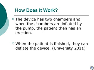 Penile implants powerpoint | PPT