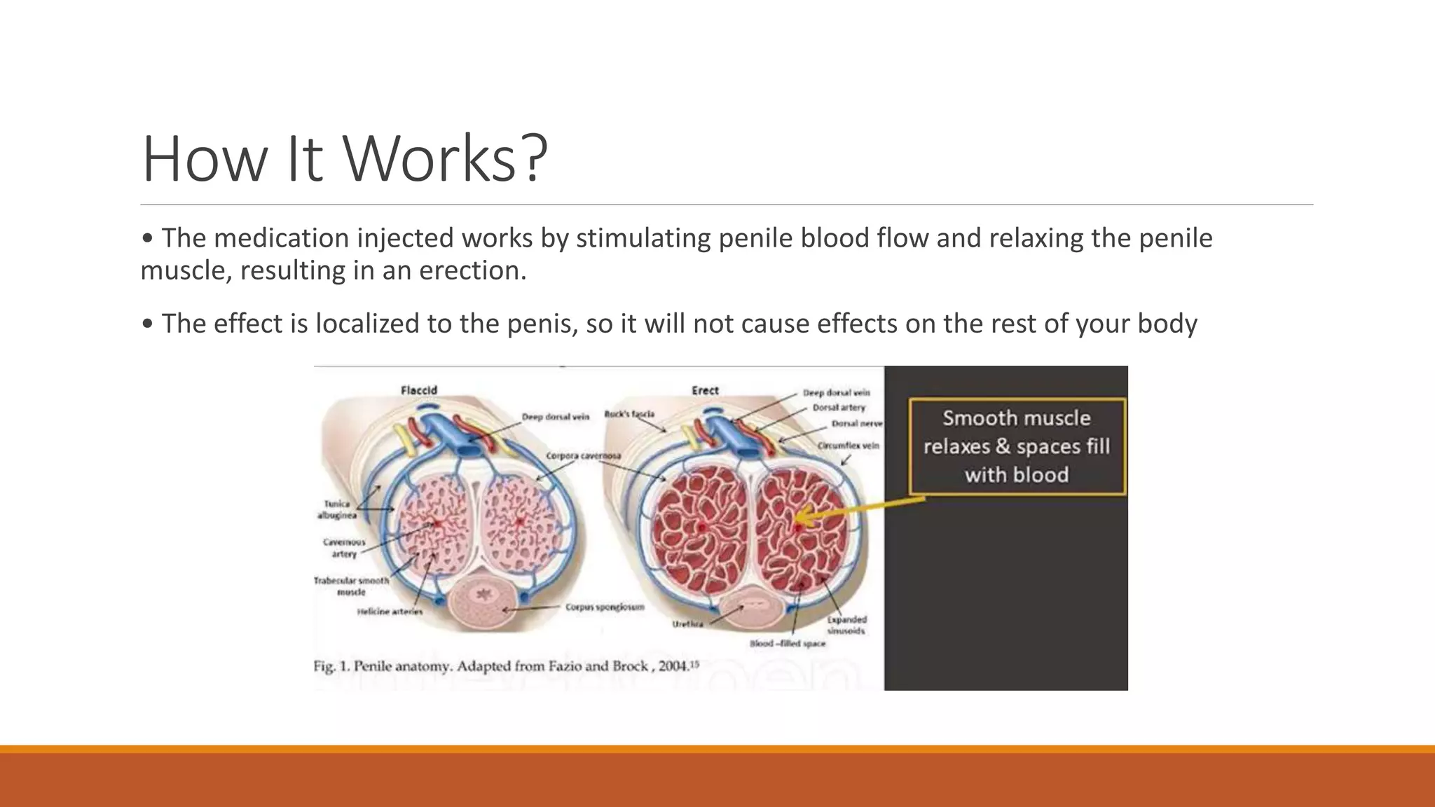 Penile injection therapy | PPTX