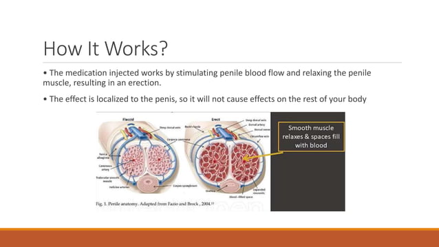 Penile Injection Therapy Ppt