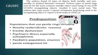 Penile strangulation | PPTX