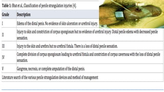 Penile strangulation | PPTX