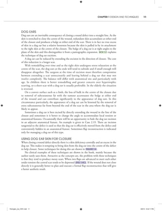 Local Flap Reconstruction - sample chapter | PDF