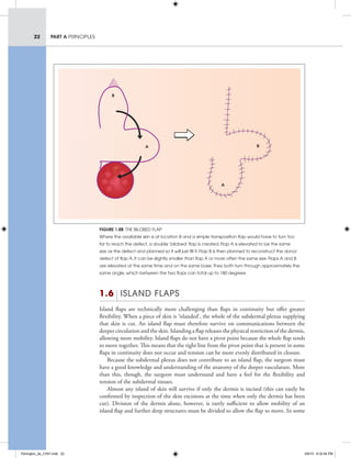 Local Flap Reconstruction - sample chapter | PDF