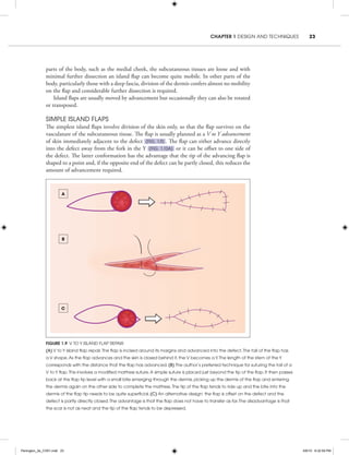 Local Flap Reconstruction - sample chapter | PDF