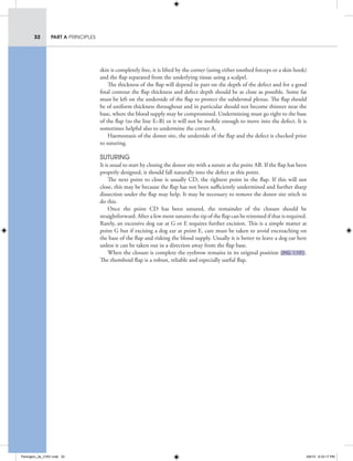 Local Flap Reconstruction - sample chapter | PDF