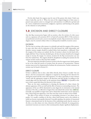 Local Flap Reconstruction - sample chapter | PDF