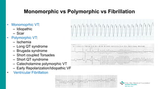 Ventricular Arrhythmias: Ablating Our Way Out of Cardiomyopathy and ...