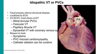 Ventricular Arrhythmias: Ablating Our Way Out of Cardiomyopathy and ...