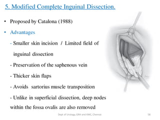 Penis carcinoma- overview | PDF