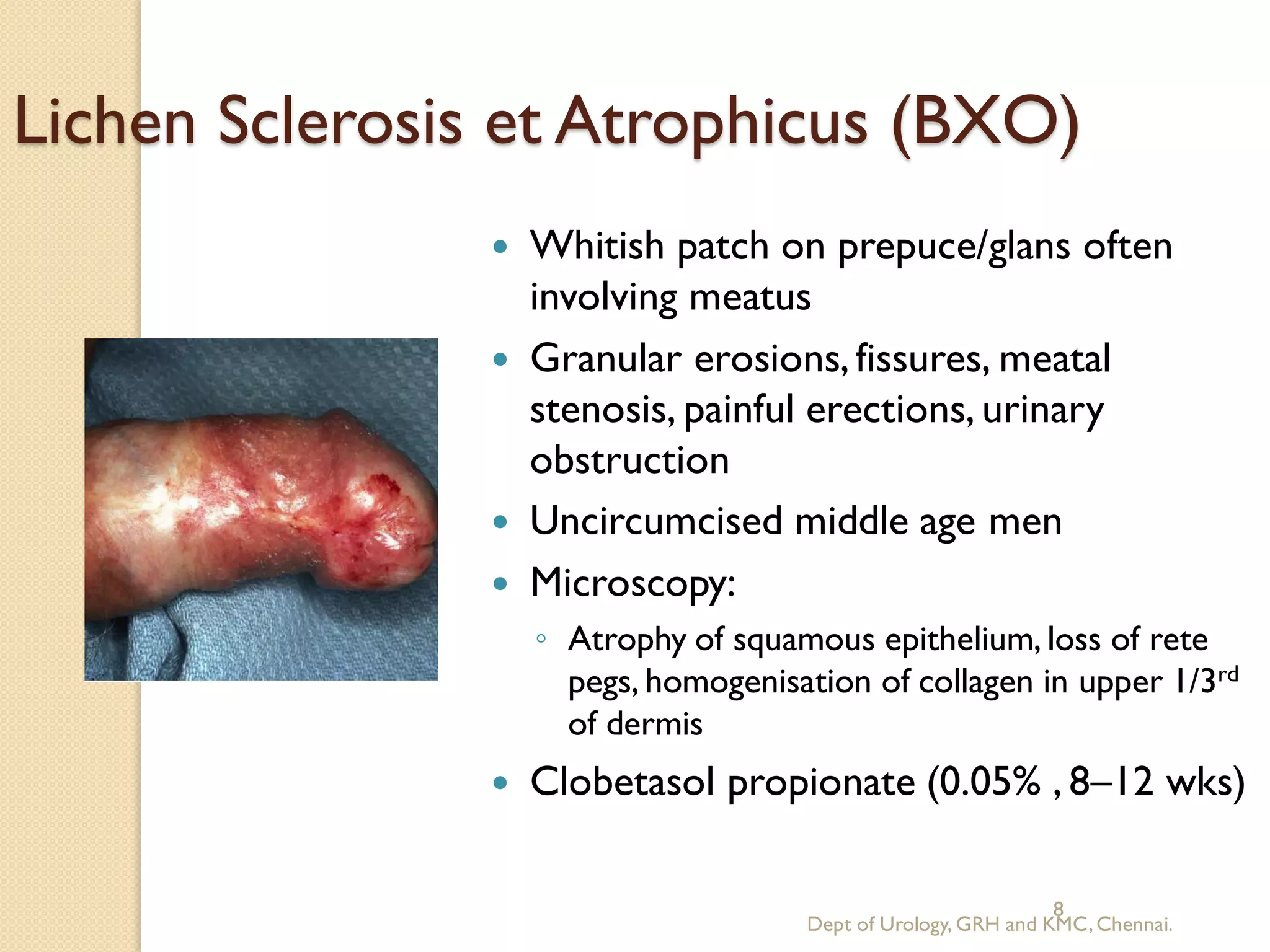 Penis carcinoma- premalignant and management algorithm | PDF