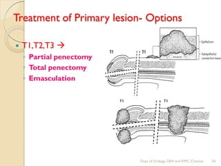 Penis carcinoma- premalignant and management algorithm | PDF