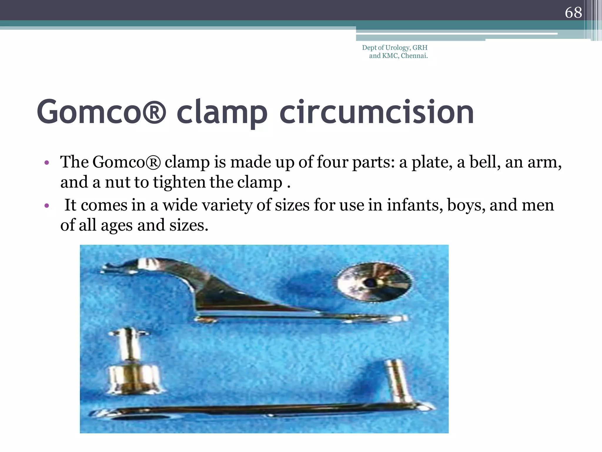 Penis phimosis & circumcision | PDF