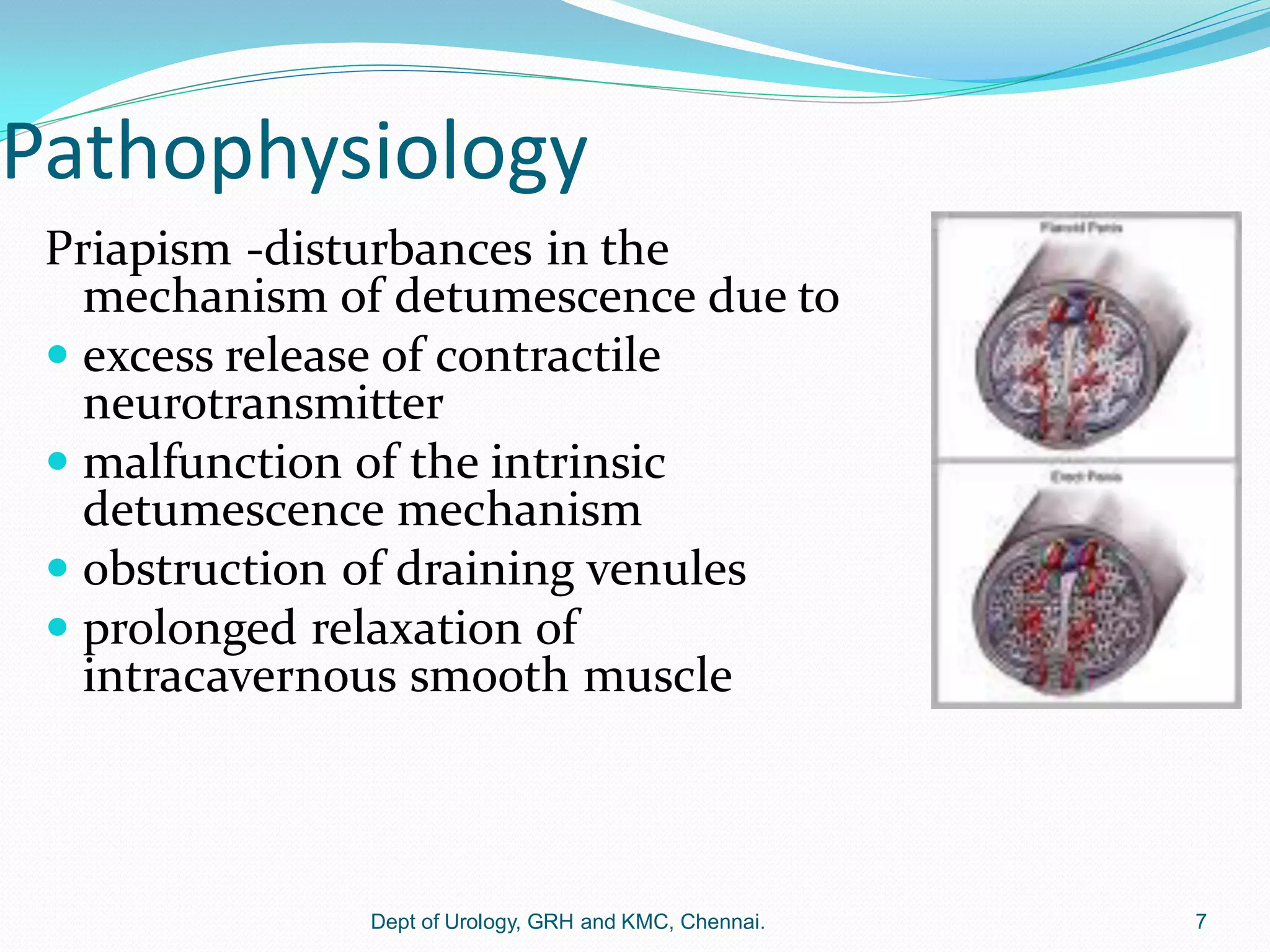 Penis priapism | PDF