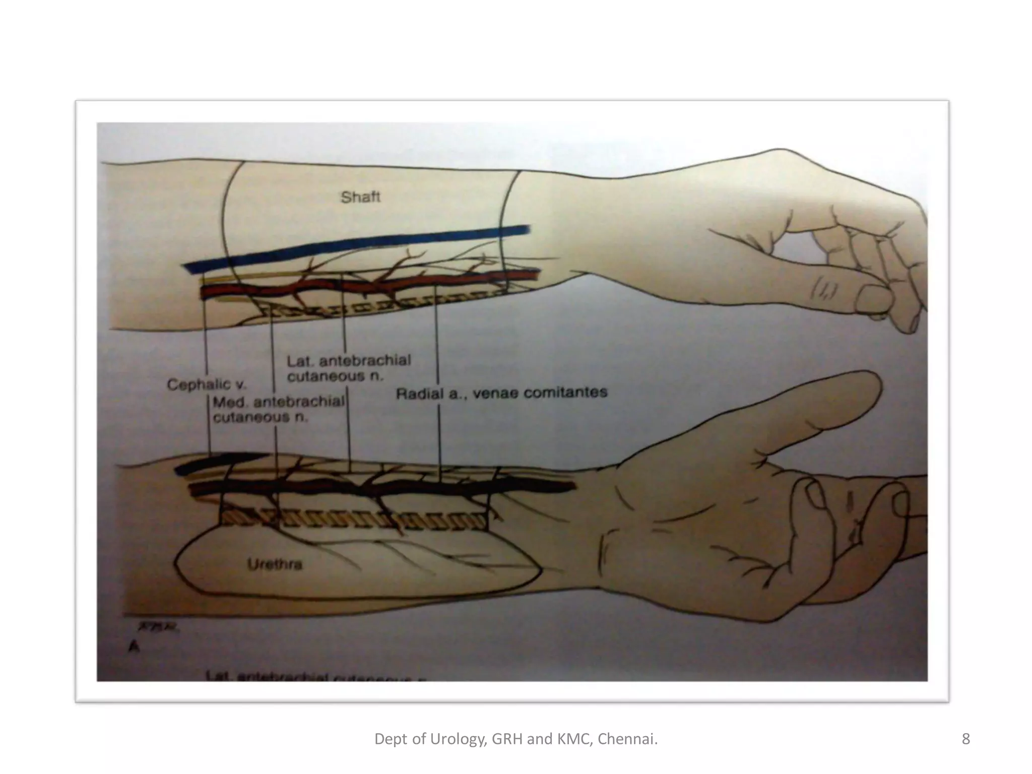 Penis Total Penile Reconstruction Pdf
