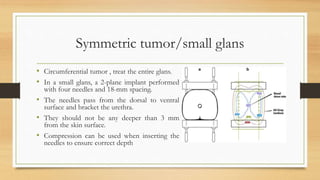 Penis journal club | PPT