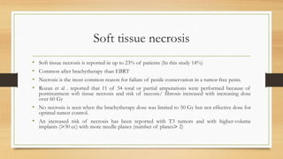 Penis journal club | PPT