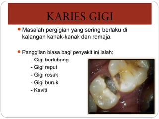 Penjagaan gigi | PPT