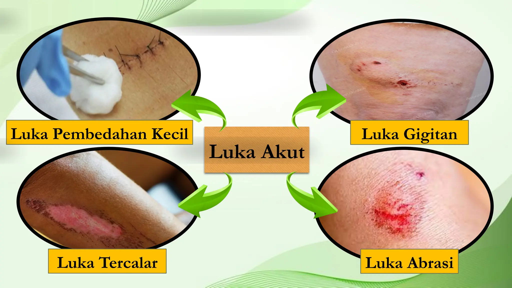 PENJAGAAN LUKA FLIP CHART NURUL AKMA BARU.pptx